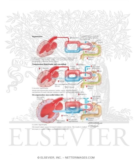 Hypertension and Congestive Heart Failure