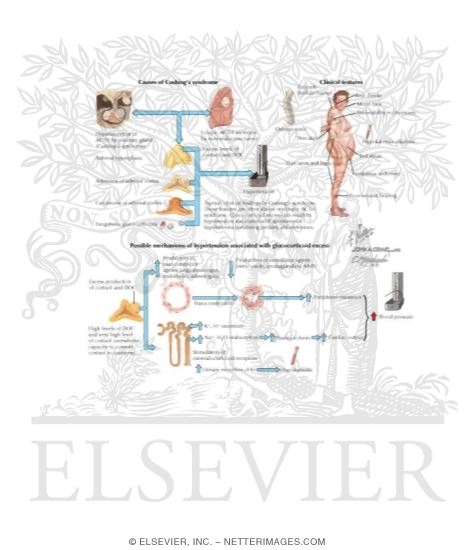 Cushing's Syndrome and Mineralocorticoid Hypertension
