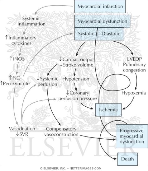 Classic Paradigm of Cardiogenic Shock