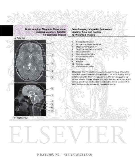 Brain Imaging: Magnetic Resonance Imaging, Axial and Sagittal T2 ...