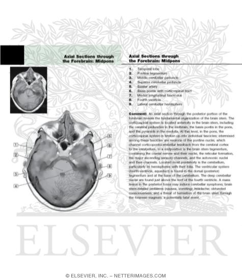 Axial (Horizontal) Sections Through the Forebrain: Level 1 - Mid Pons