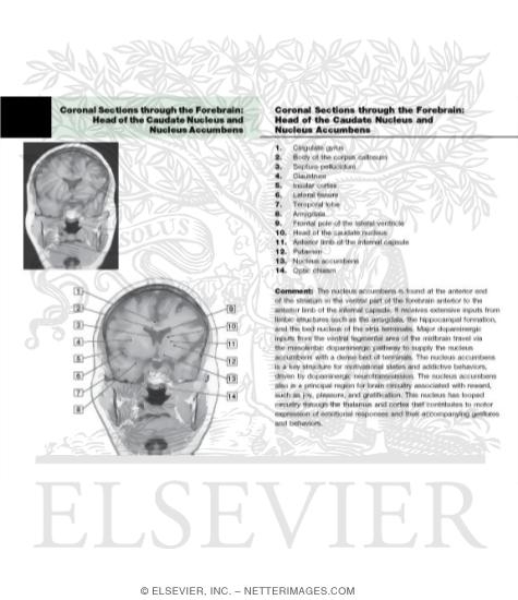 Coronal Sections Through the Forebrain: Level 1 - Genu of Corpus Callosum