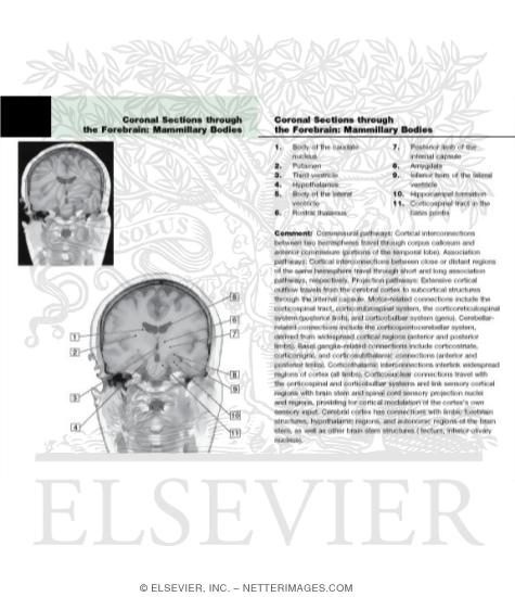 Coronal Sections Through the Forebrain: Level 5 - Mammillary Body