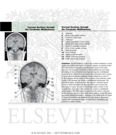 Coronal Sections Through the Forebrain: Level 7 - Midthalamus