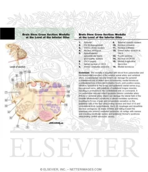 Medulla - Level of the Inferior Olive