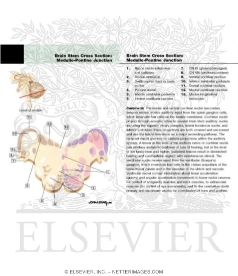 Medullo-Pontine Junction - Level of the Cochlear Nuclei