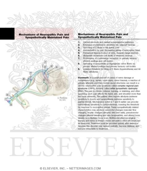 Mechanisms of Neuropathic Pain and Sympathetically Maintained Pain