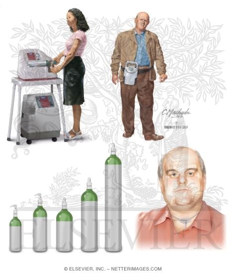Oxygen Therapy In Chronic Respiratory Failure (Ambulatory and Home Use)