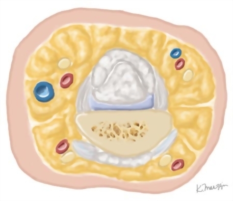 Cross Section of the Hand: Axial View