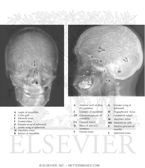 Skull: Anteroposterior and Lateral Radiograph