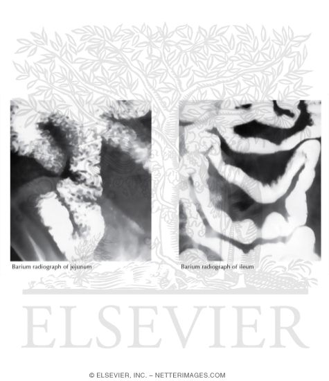 Small Intestine: Radiographs