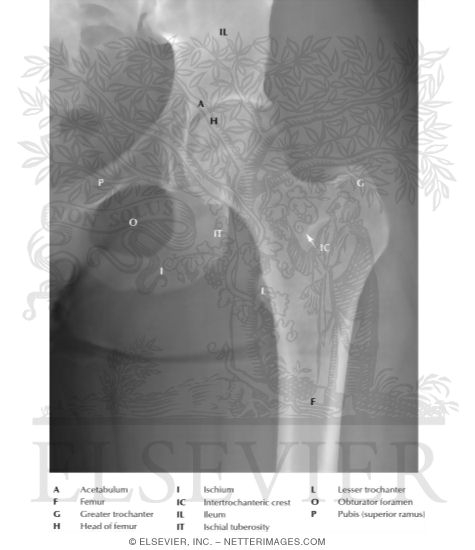 Hip Joint: Anteroposterior Radiograph