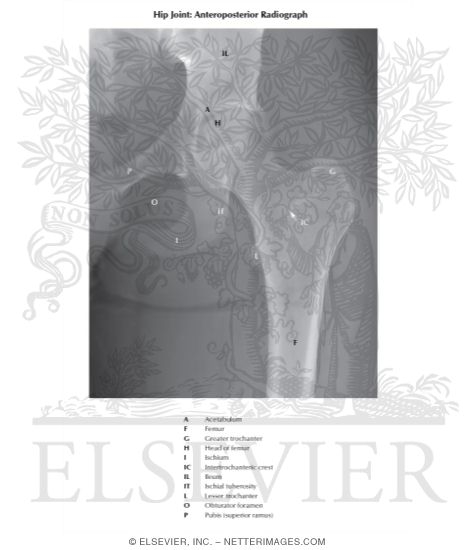 Hip Joint: Anteroposterior Radiograph