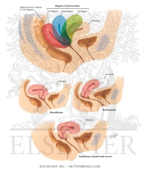 normal uterus position
