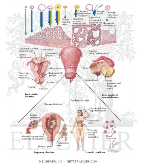 female bleeding causes