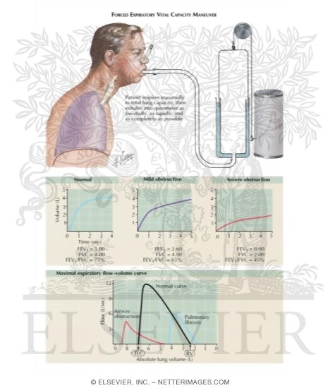 Forced Expiratory Vital Capacity Maneuver