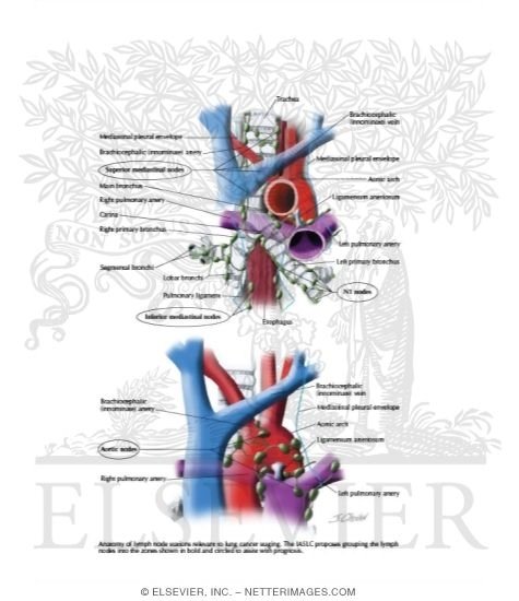 Regional Lymph Node Stations for Lung Cancer Staging