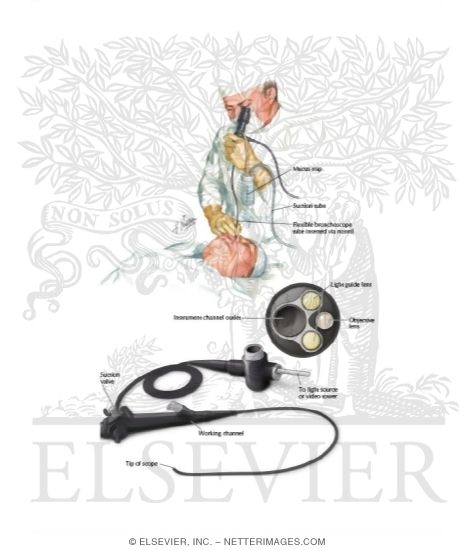 flexible bronchoscopy