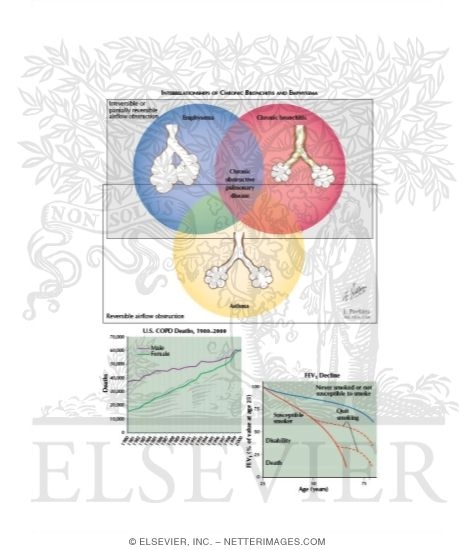 COPD: Clinical Types and Natural History