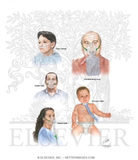 Methods of Oxygen Administration