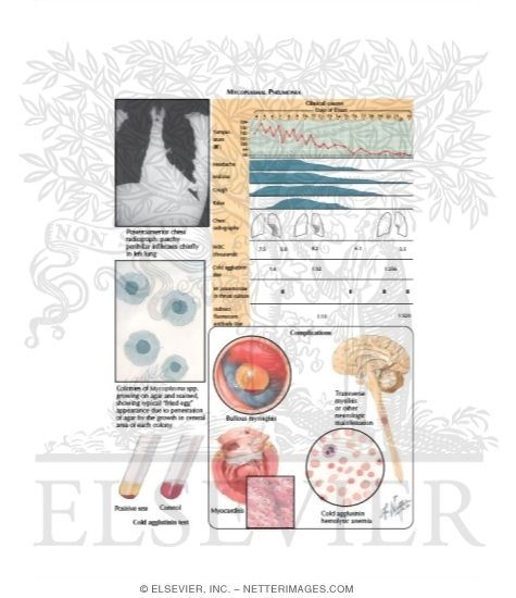 Atypical Pathogen Pneumonia