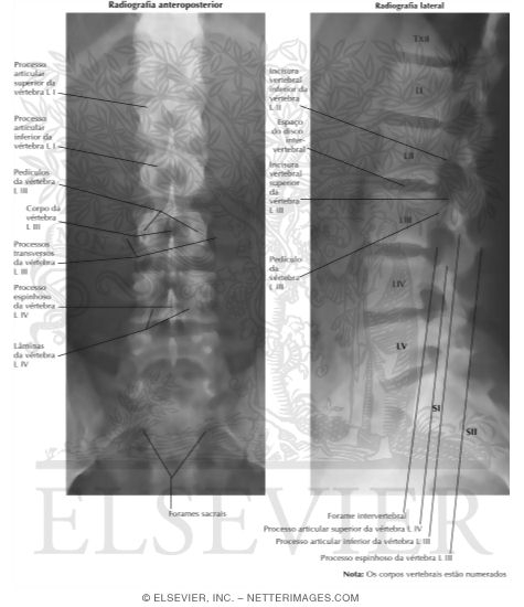 Lumbar Vertebrae: Radiographs