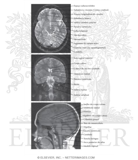 Cranial Imaging (MRI)