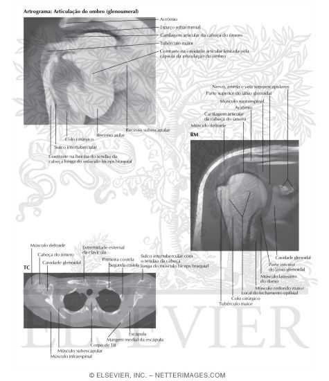 Shoulder Arthrogram, MRI and CT