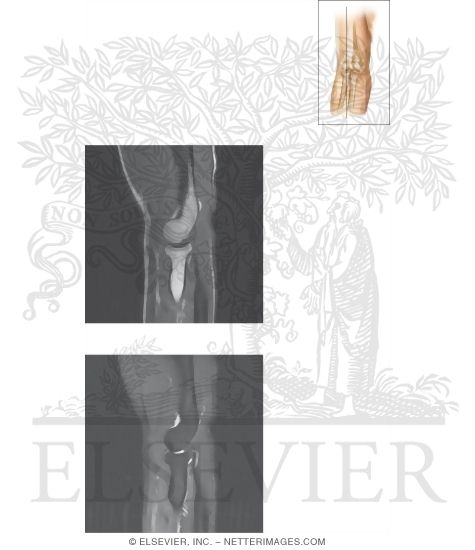 Watermarked preview of unlabeled image: Cross Section of the Elbow ...