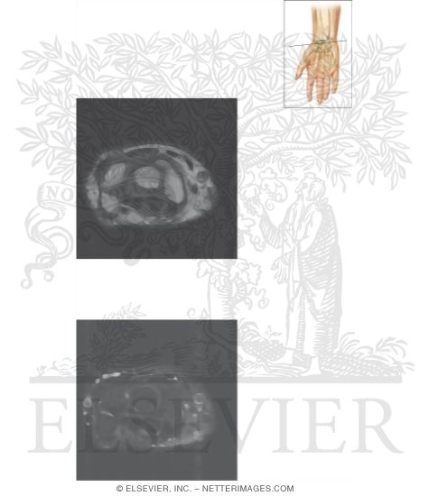 Cross Section of the Wrist: Axial View
