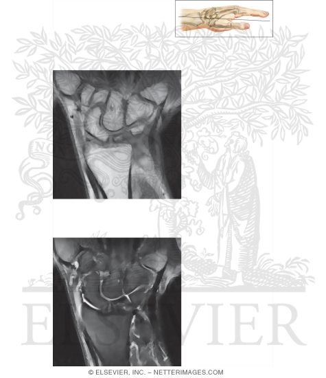 Cross Section of the Wrist: Coronal View