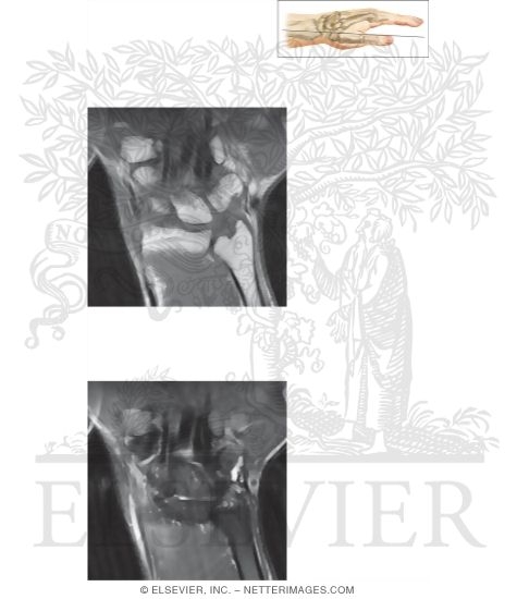 Cross Section of the Wrist: Coronal View