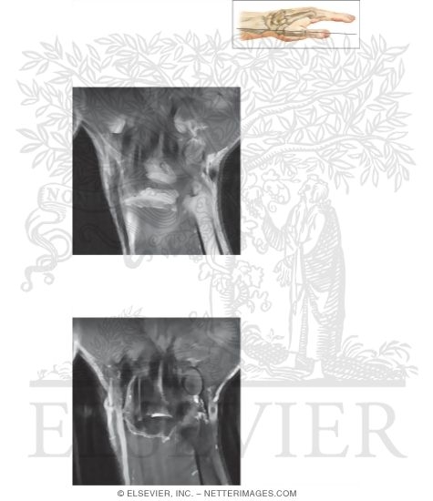 Cross Section of the Wrist: Coronal View