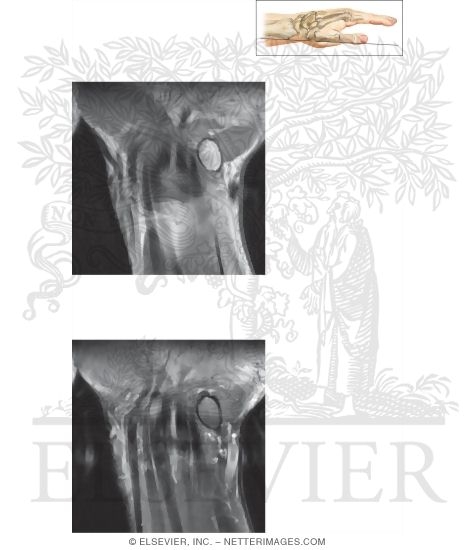 Cross Section of the Wrist: Coronal View
