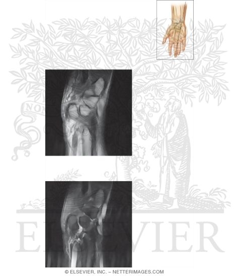 Cross Section of the Wrist: Sagittal View