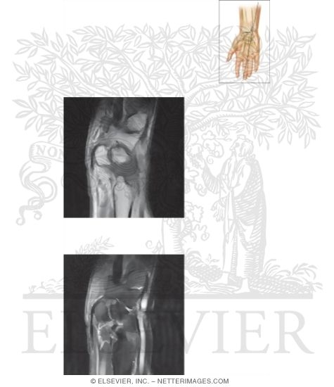 Cross Section of the Wrist: Sagittal View