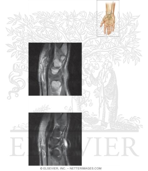 Cross Section of the Wrist: Sagittal View