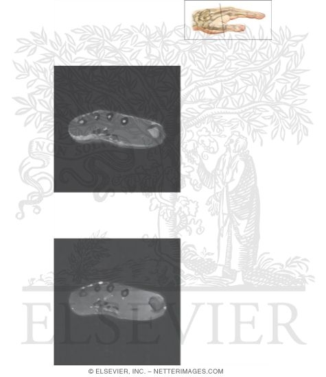 Watermarked preview of unlabeled image: Cross Section of the Hand ...