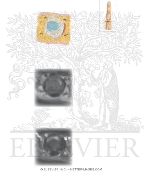 Cross Section of the Finger: Axial View