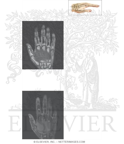 Cross Section of the Hand and Finger: Coronal View