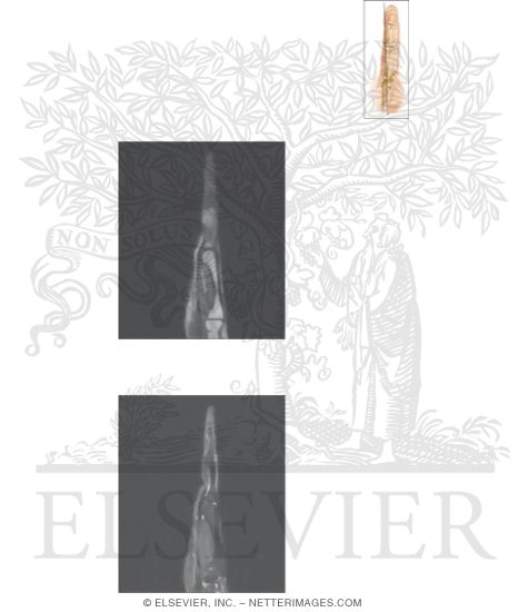 Cross Section of the Hand and Finger: Sagittal View