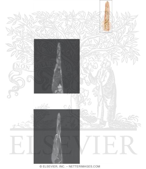 Cross Section of the Hand and Finger: Sagittal View