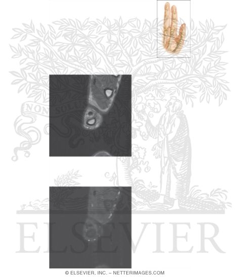 Watermarked preview of unlabeled image: Cross Section of the Thumb ...