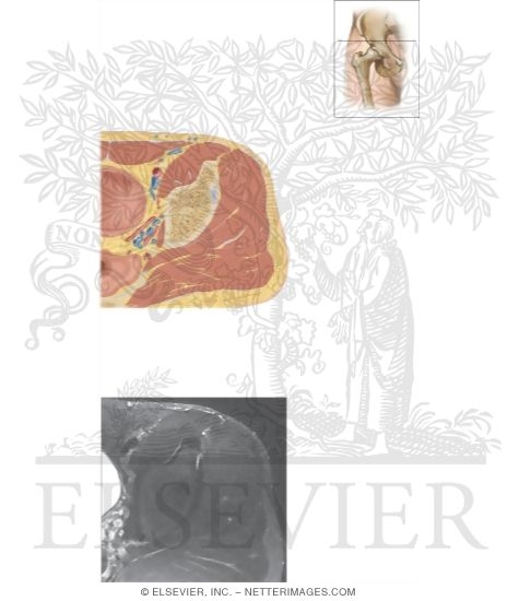 Cross Section of the Hip: Axial View