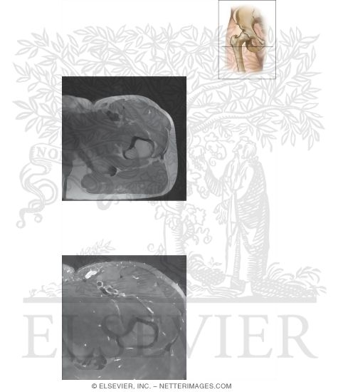 Watermarked preview of unlabeled image: Cross Section of the Hip: Axial ...