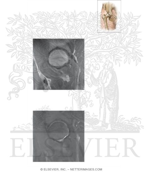 Cross Section of the Hip: Sagittal View