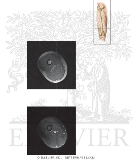 Left Thigh Cross Section