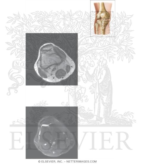 Cross Section of the Knee: Axial View