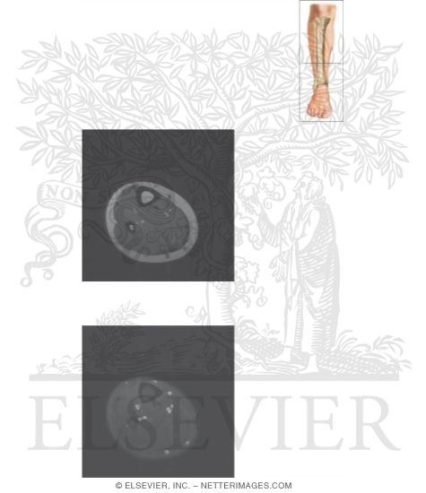 Cross Section of the Lower Leg: Axial View