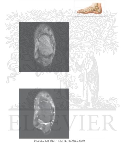 Cross Section of the Ankle and Foot: Axial View